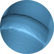 3D Surface Inspection and Analysis Solution